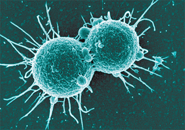 Marine bacteria that degrade PBS, Japanese study finds | PLALEAVES